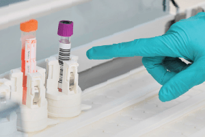 Intelligent Tube Routing in Lab Automation Can Improve Turnaround Times