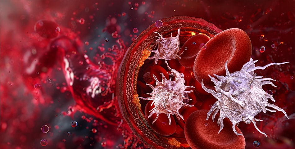 The Value of Mean Platelet Volume (MPV) in Hematology | Beckman Coulter