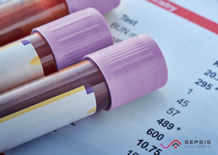 Sepsis Alliance More to the CBC | Beckman Coulter