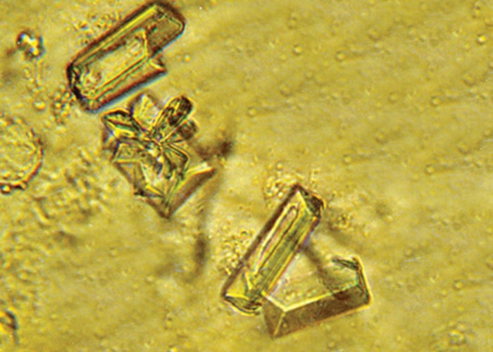 Comparing Automated Microscopy Data to Manual Review | Beckman Coulter