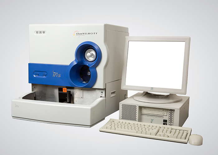 Urinary Tract Infection Screening Using Automated Urinalysis | Beckman ...