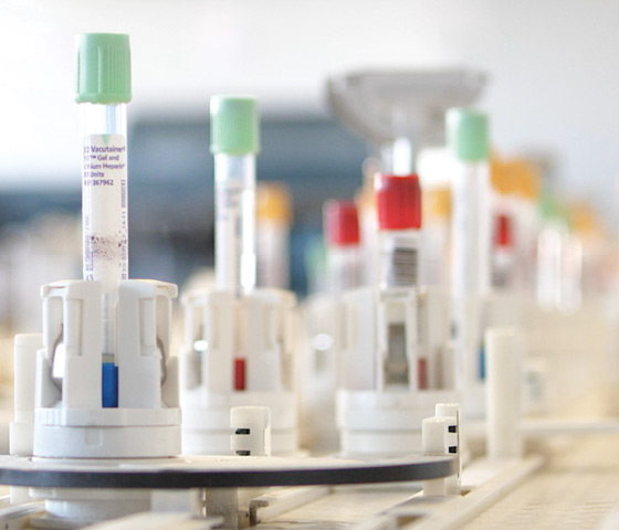 DxA 5000 What Drives You | Beckman Coulter