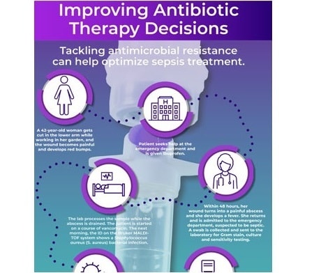 Sepsis Diagnosis and Management in the Lab | Beckman Coulter