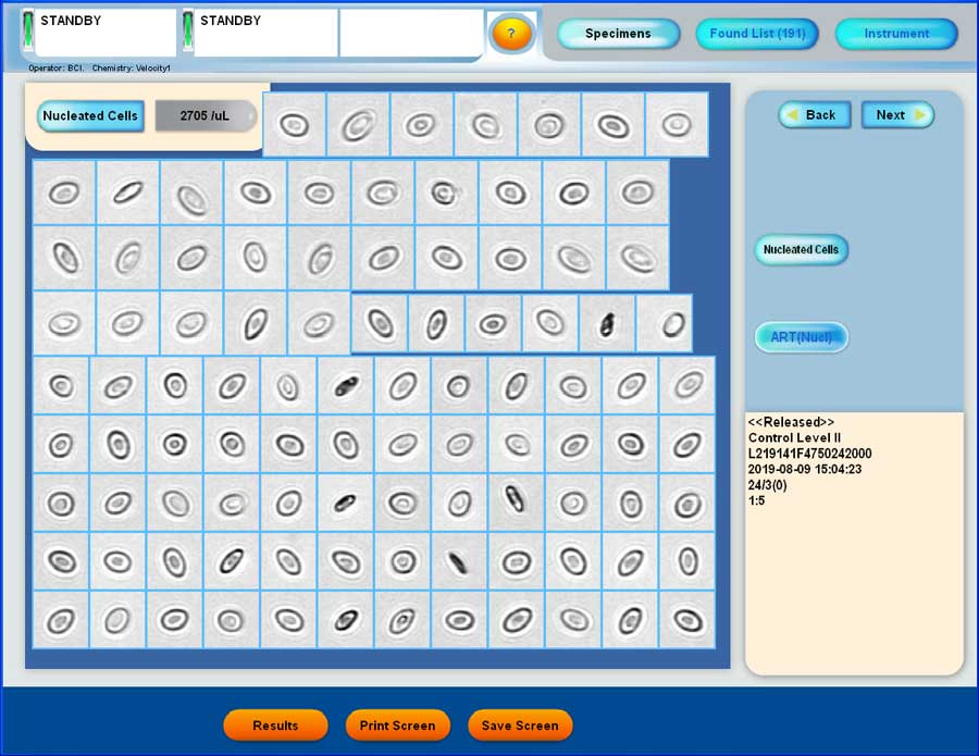 Streamlined Body Fluid Analysis | Beckman Coulter