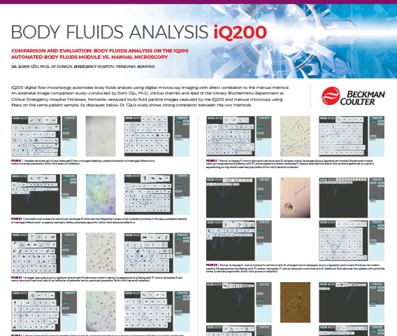 Streamlined Body Fluid Analysis | Beckman Coulter